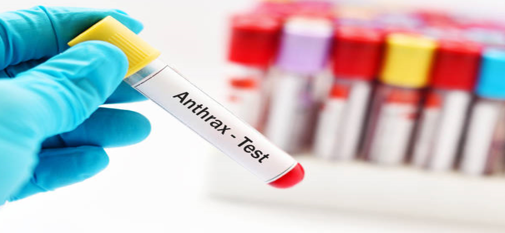 Anthrax Disease: Causes, Symptoms, Prevention - SilverbirdTV